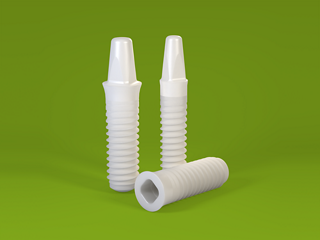 The Straumann Dental Implant System